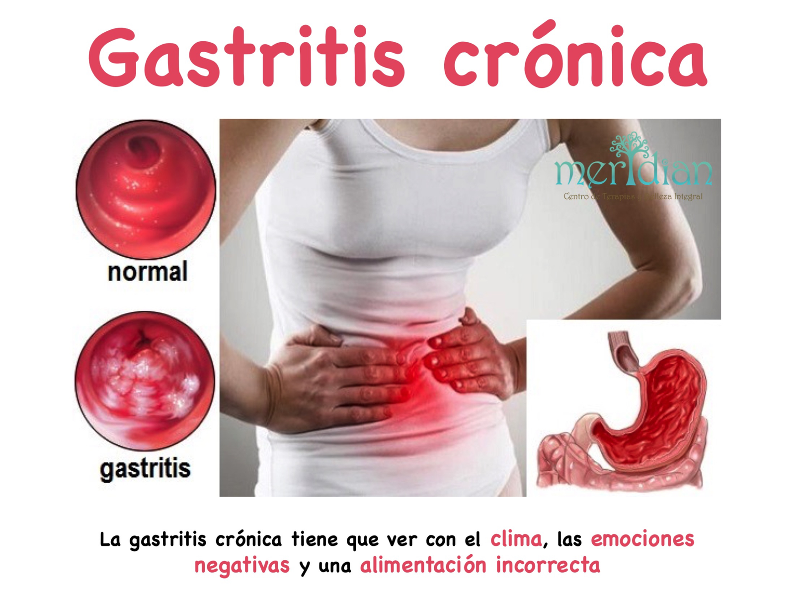 Qué Es Gastritis Crónica Asociada A Helicobacter Pylori